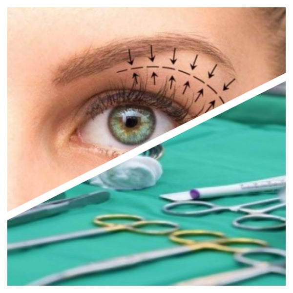 Blepharoplasty Surgery Instruments Set | ShaGha